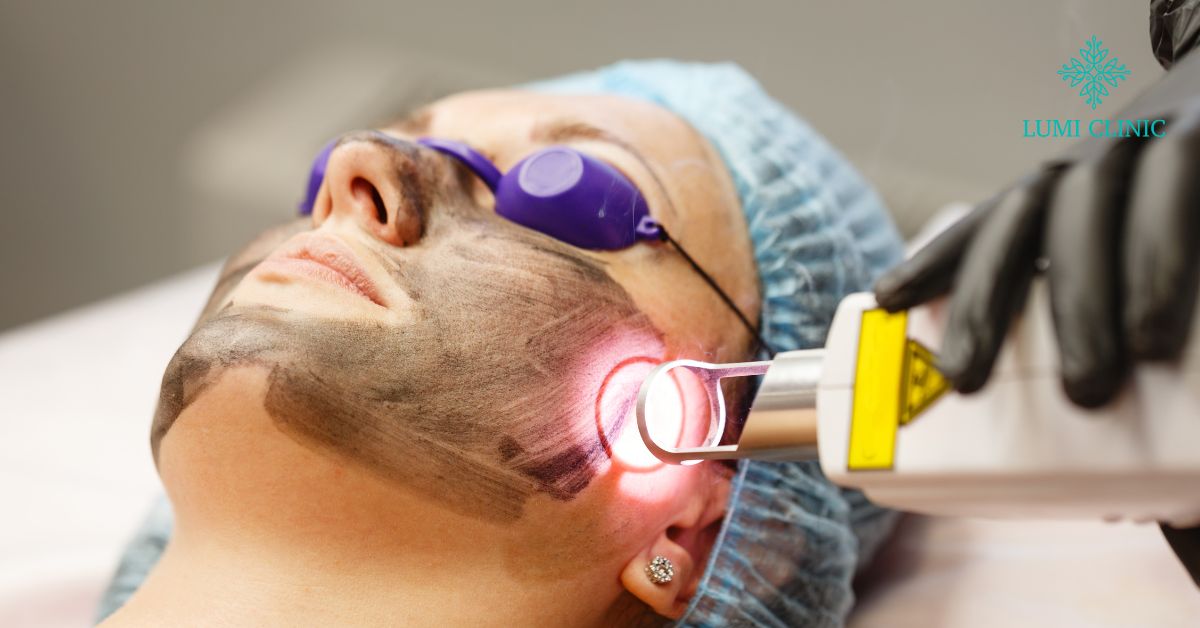 Unlock the Full Benefits of Pico Laser Treatments for Radiant, Youthful ...